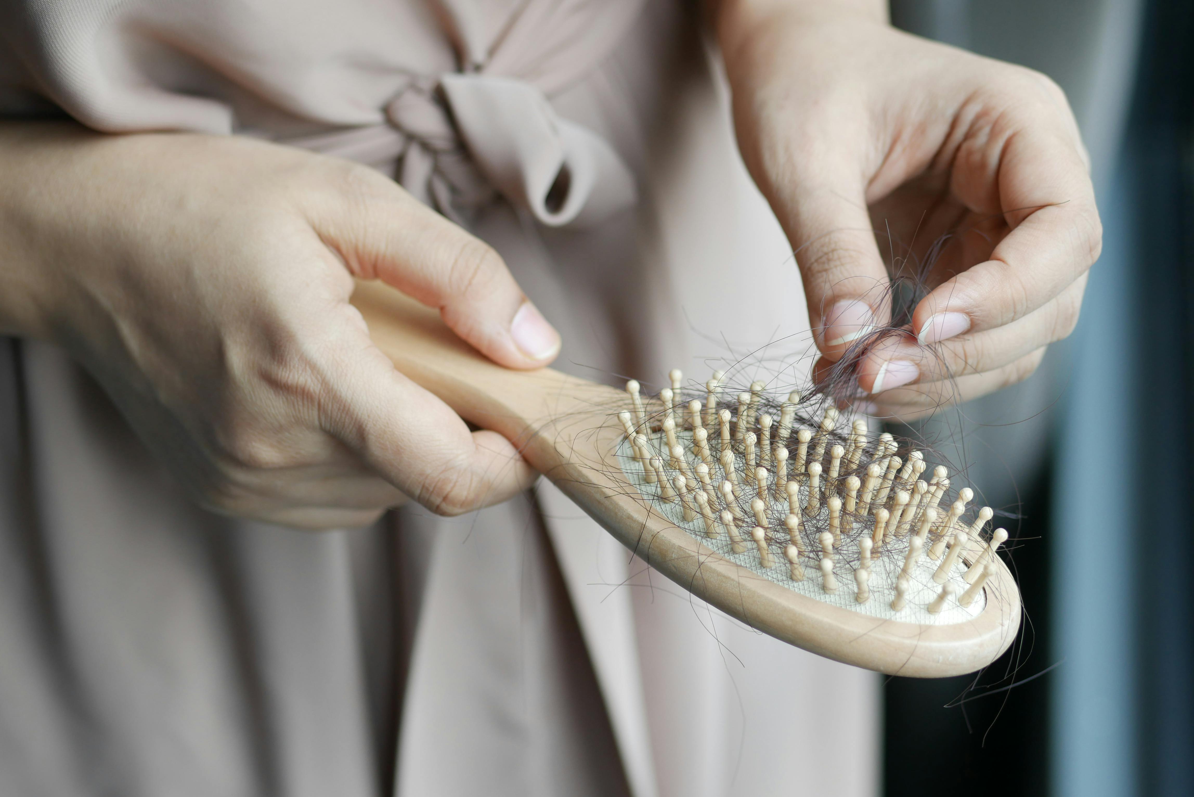 How to prevent hair from falling out naturally – TheLaurenAshtynCollection